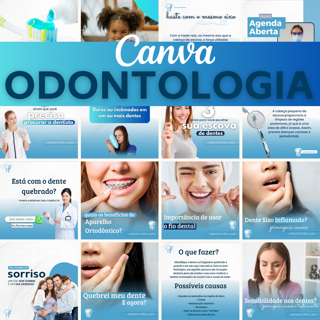 Clareamento dental: tipos, resultados e cuidados necessários — tudo o ...